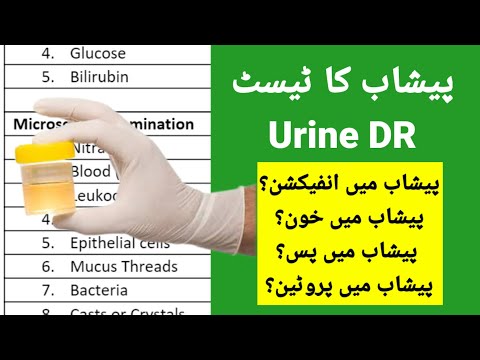 Urine Test in Hindi/Urdu | Understand Urine Analysis Report | How to Read Urinalysis Result