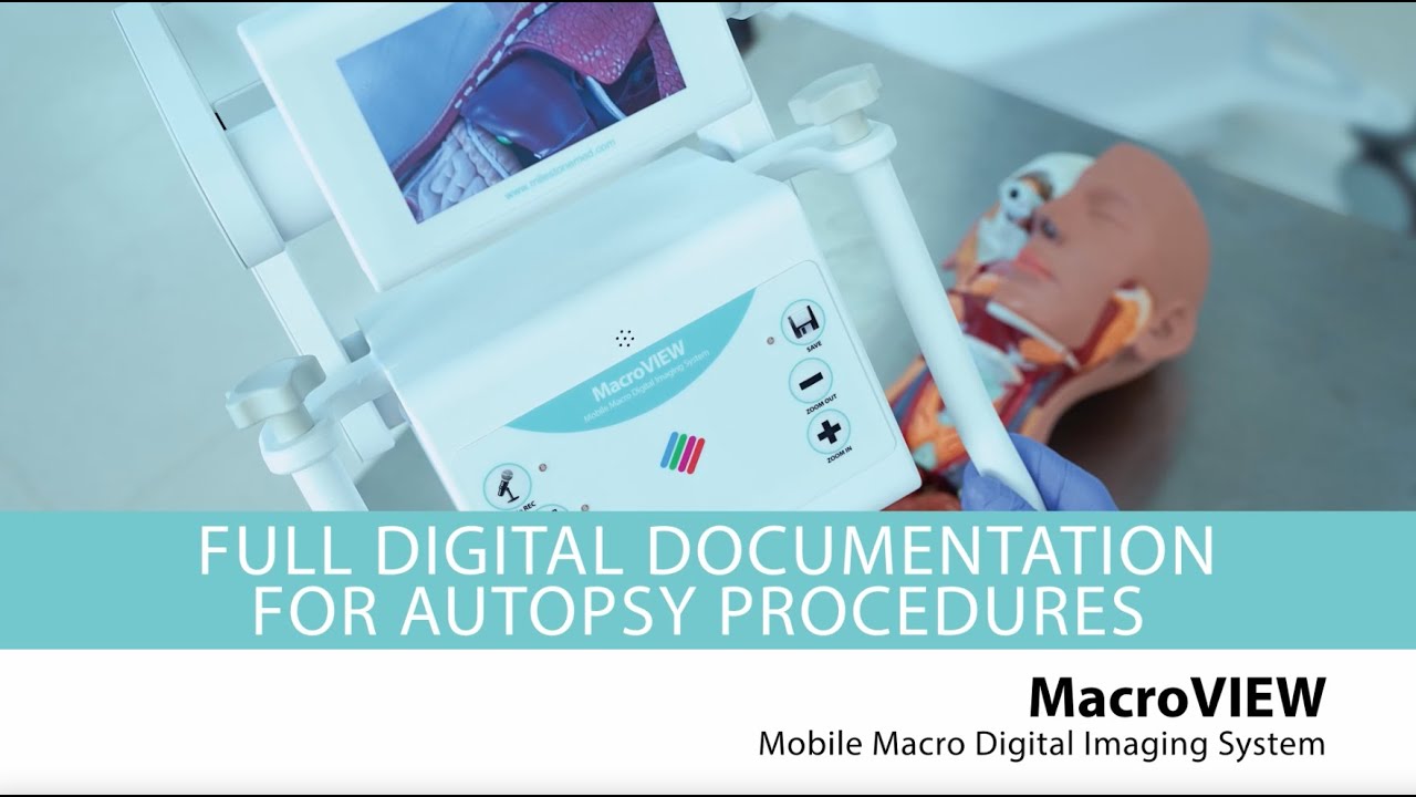 MacroVIEW - Full Digital Documentation for Autopsy Procedures