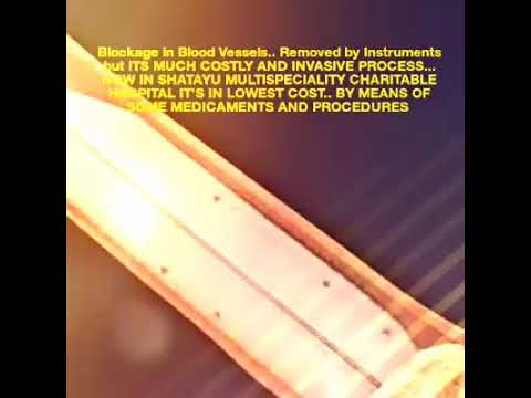 Treatment Of Blockage and Kidney Stones!
