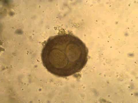 Parascaris Equorum Egg