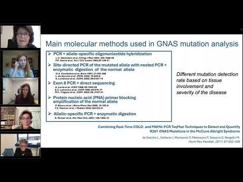 Fibrous Dysplasia with emphasis on hypophosphataemia 2 (reupload with new data)