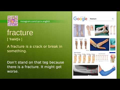 Fracture : C2 level english vocabulary lesson, www.LipLix.com