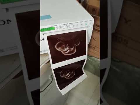TEST 2 SONY UPP 110 HG