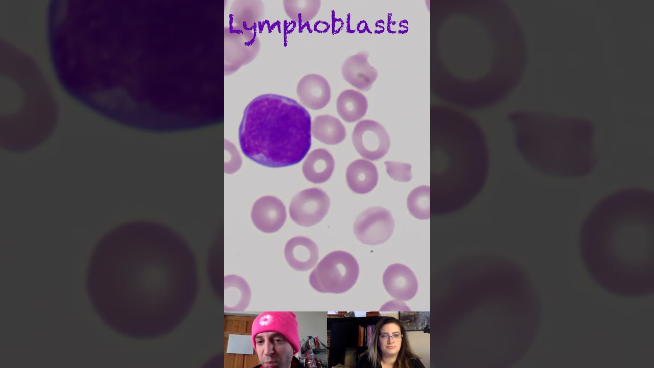 Lymphoblast Morphological Characteristics