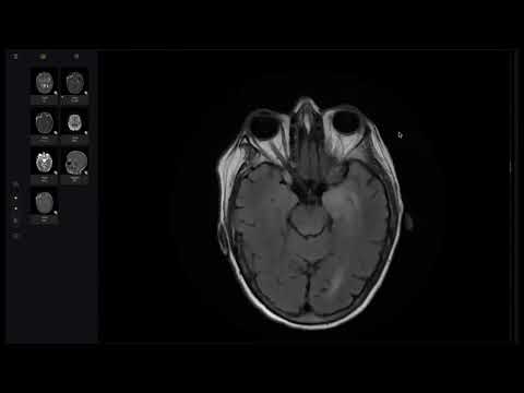 Mixed Viva cases 7 (Part 1)