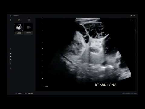 Hepatobiliary Viva cases 1 (part 1)