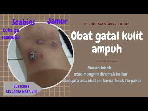 obat gatal obat luka ampuh murah