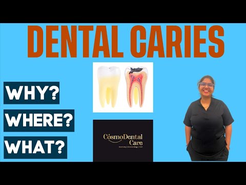 The Surprising Truth About Cavities