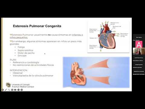 Abordaje de cardiopatias congénitas