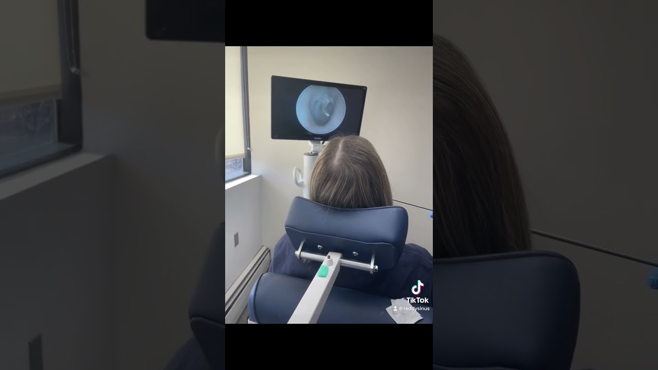 What a normal ear drum looks like vs a retracted ear drum