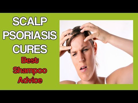 Best Shampoo For Psoriasis - FAST WORKING