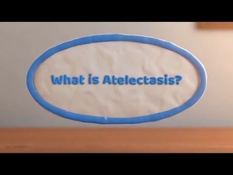 What is Atelectasis? (Complete or Partial Lung Collapse)