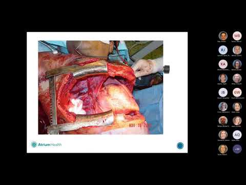 MTAC November 2021- Alphabet Soup for Trauma Patients in Extremis: ERT vs REBOA