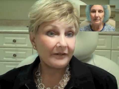 Full Facial Rejuvenation Long Island with Dr. James Marotta - Video Testimonial