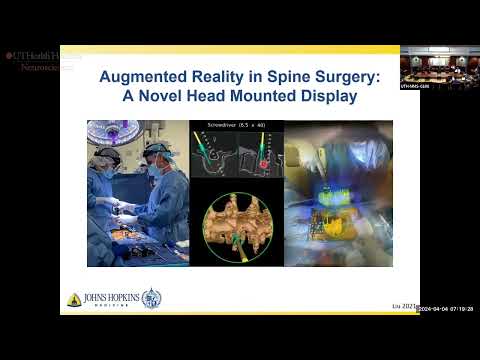 Augmented Reality In Spinal Surgery with Timothy F. Witham, MD