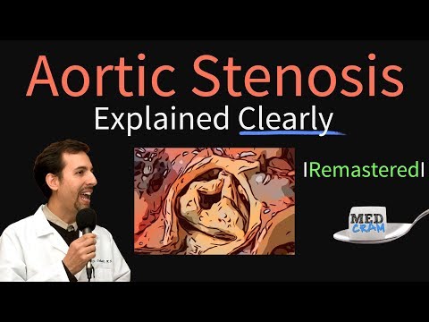 Aortic Stenosis Remastered (Symptoms, murmur, aortic valve stenosis treatment)