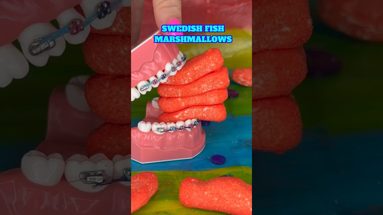 CANDY YOU CAN EAT WITH BRACES 👀 SHARK WEEK 🦈 ORTHODONTIST REACTS SATISFYING CANDY FOOD ASMR
