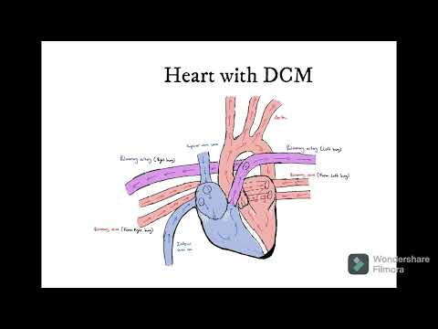 Dilated Cardiomyopathy in Canines: Pathophysiology, Diagnosis, Treatment, and Prevention