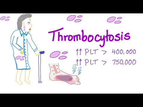 Thrombocytosis (Primary and Secondary) - Why Is My Platelet Count High? - Hematology