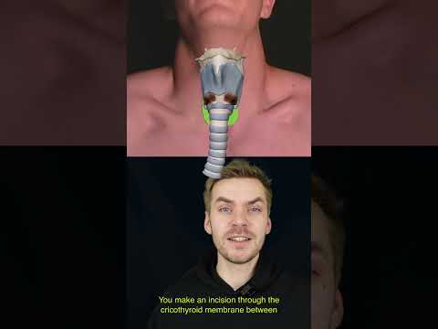 Anatomy of cricothyrotomy (emergency airways)