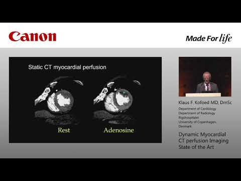 Prof. Klaus Fuglsang Kofoed at ESCR 2019