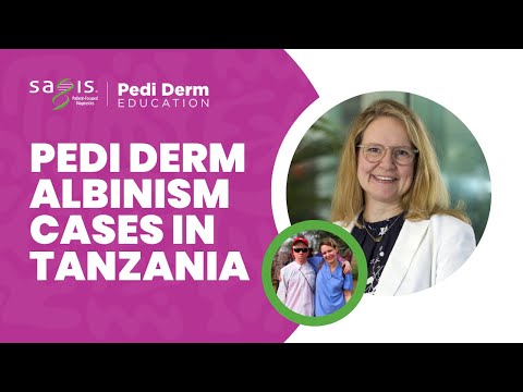 Pedi Derm Education: Albinism Cases in Tanzania