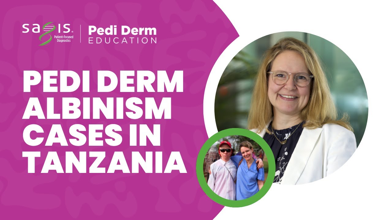 Pedi Derm Education: Albinism Cases in Tanzania