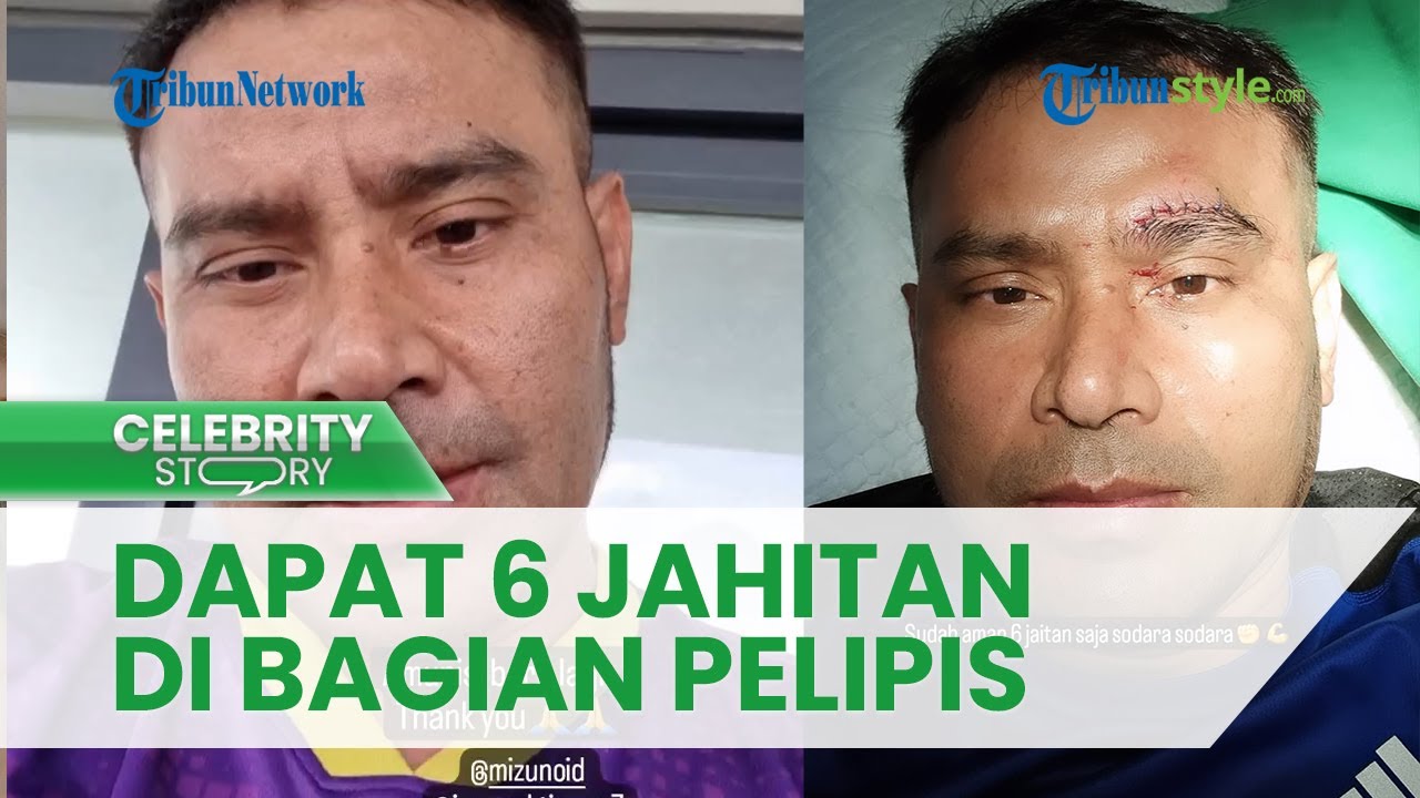 Dapat 6 Jahitan di Bagian Pelipis, Pilu Judika Dimarahi sang Istri ...