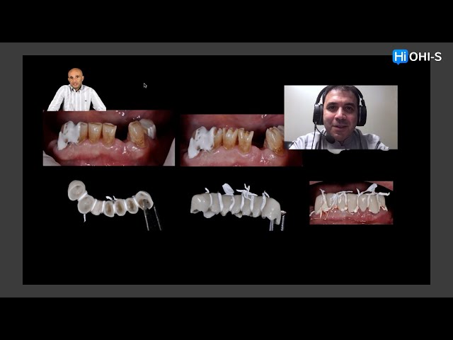 Курс Паскаля Венутти и Марко Майолино - протоколы вертипреп