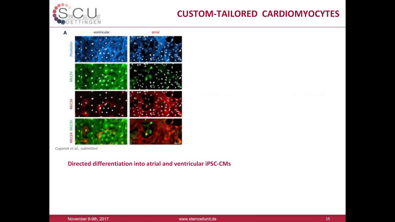 Differentiation of human pluripotent stem cells into atrial and ventricular cardiomyocyte subtypes