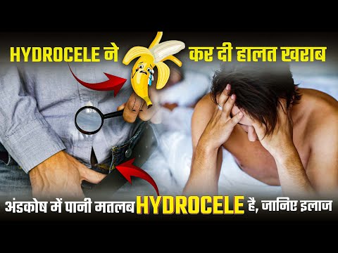 hydrocele ka ilaj kya hai | Dr. Himanshu Bharat Homeopathy