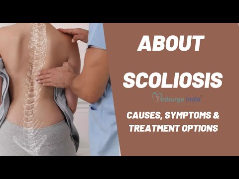 About Scoliosis Surgery | Scoliosis - Causes, Symptoms & Treatment