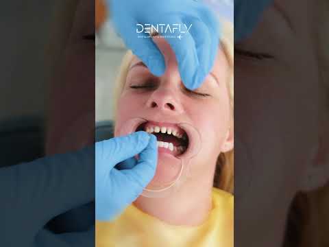 How to Put Zirconium Crowns on a Preperated Tooth? #shorts #shortsvideo #fyp #trendingshorts #teeth