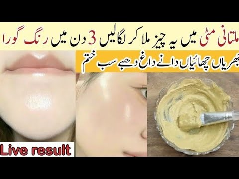 Multani mitti face pack| multani mitti face wash | skin whitening home remedies|how to get fair skin