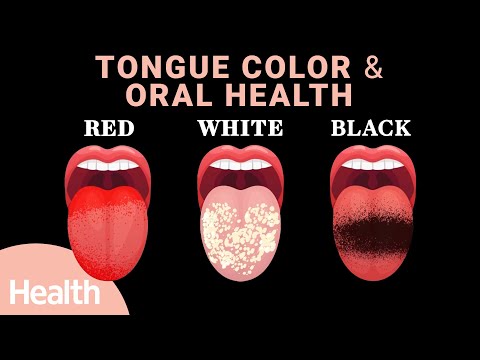 What Your Tongue Tells You About Your Health | Tongue Color, Taste Buds, COVID Tongue, & Oral Health