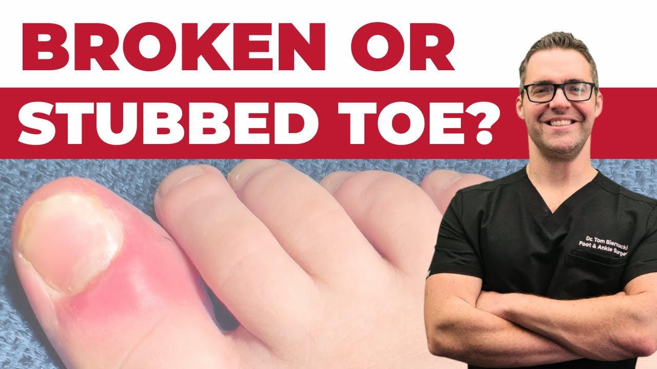 Stubbed Toe vs Broken Toe: How to Tell the Difference Fast