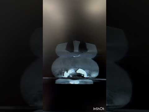 Dental Infection or Cyst !!! Surgery by Dr Nasir Abbas
