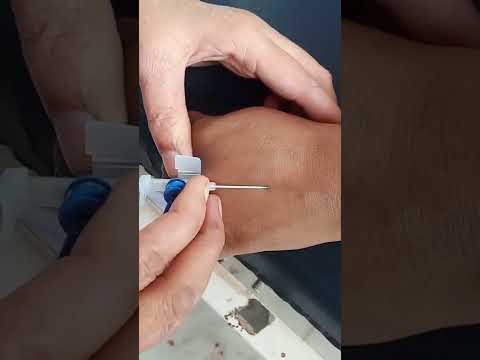 IV Cannula Insertion