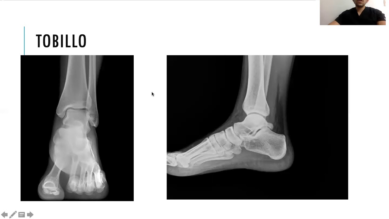 Radiología simple de miembro inferior
