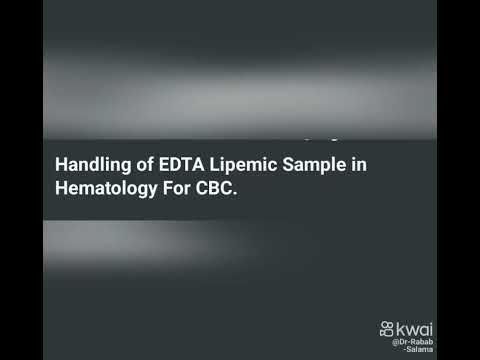 Handling EDTA lipemic sample for CBC