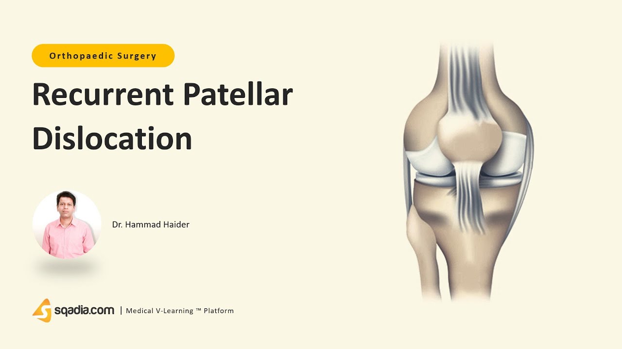 Recurrent Patellar Dislocation | Introduction