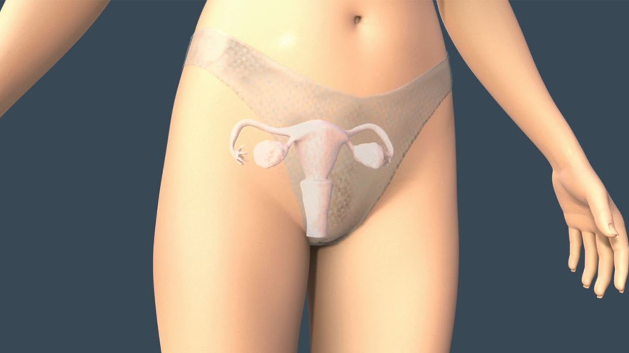 Citología vaginal o Papanicolau