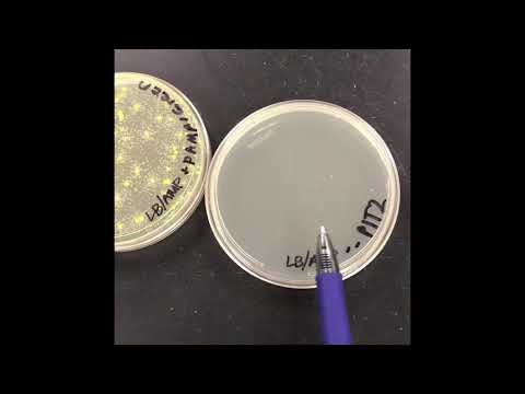 AP Bacterial Transformation Lab Day 2