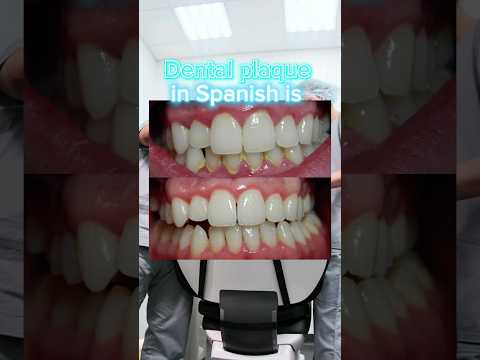 DENTAL PLAQUE IN SPANISH | Medical Consecutive Interpreting