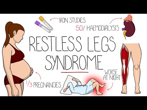 Restless Legs Syndrome Explained (Willis-Ekbom Disease)