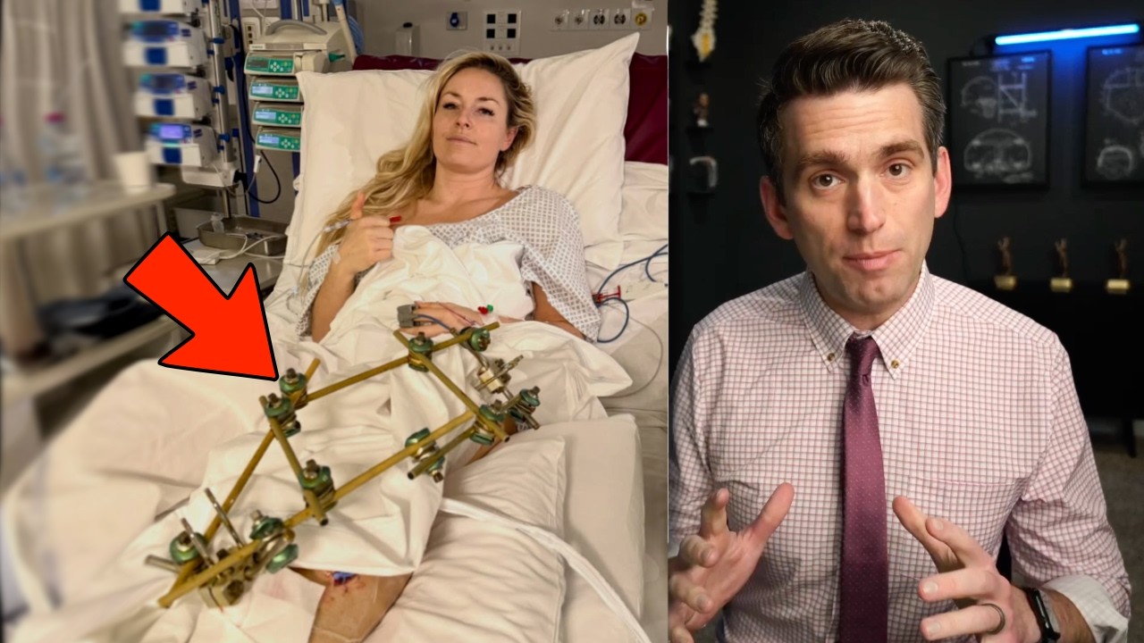 Lindsey Vonn Reveals MAJOR Update after 3rd Surgery - Doctor Explains