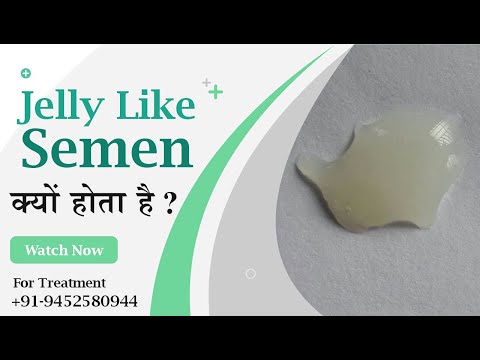 IS YOUR SPERM THICK? Dr. Nizamuddin Qasmi Answers! (Clumpy Sperm Explained) jelly like semen