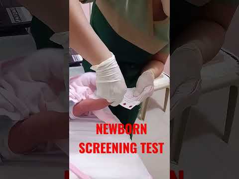 NEWBORN SCREENING TEST #shortsvideo