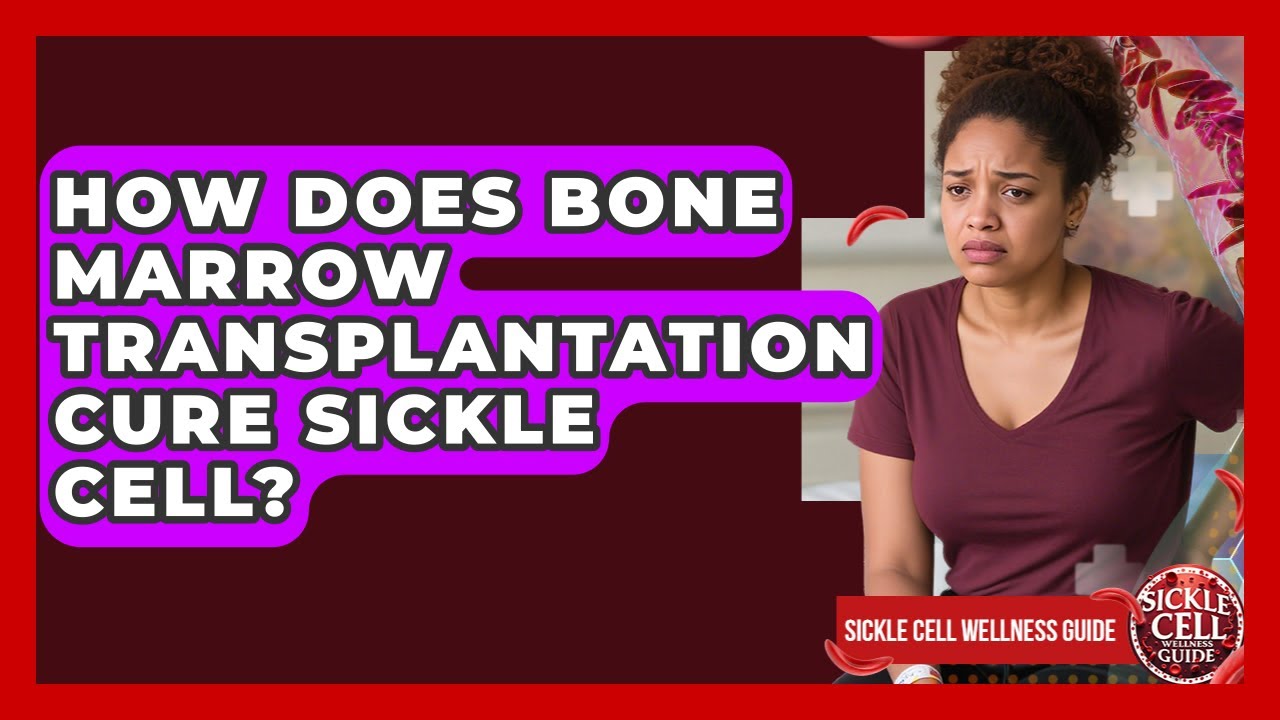 How Does Bone Marrow Transplantation Cure Sickle Cell? - Sickle Cell Wellness Guide