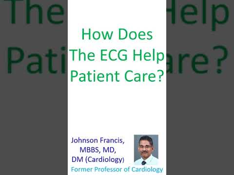 How Does The ECG Help Patient Care?
